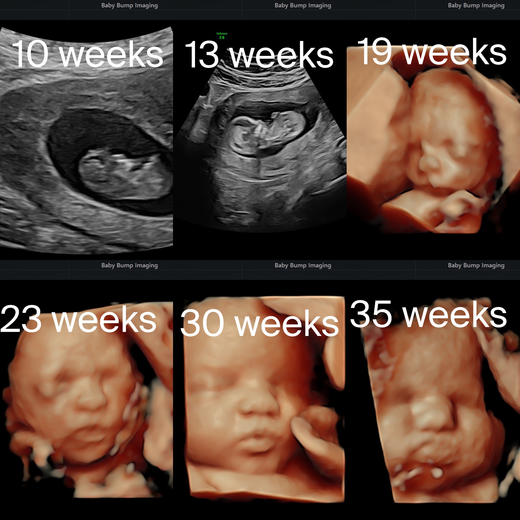 Services – Welcome To Baby Bump Imaging